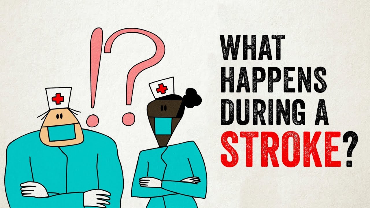 What Happens During A Stroke Vaibhav Goswami Cctubes